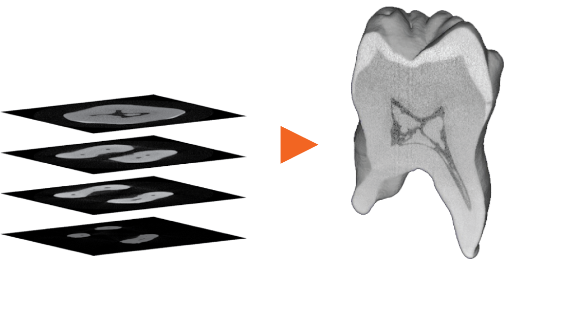 Scanco μCT 45/50/100 X-ray Micro Tomography
