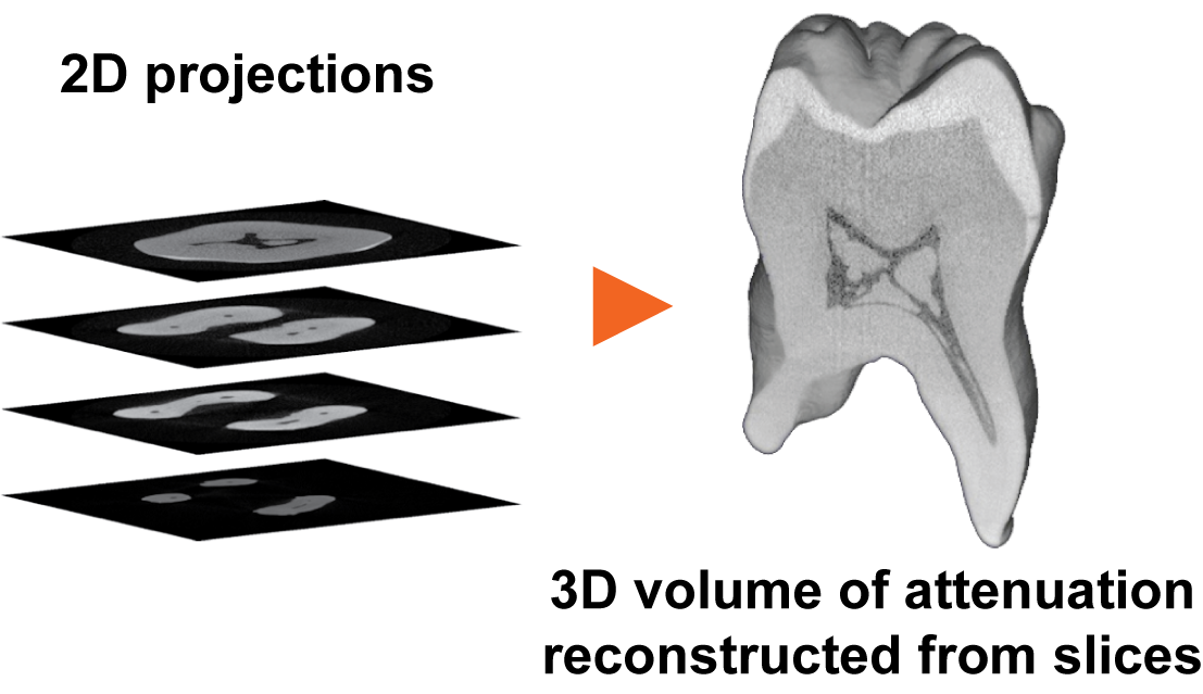 Scanco μCT 45/50/100 X-ray Micro Tomography